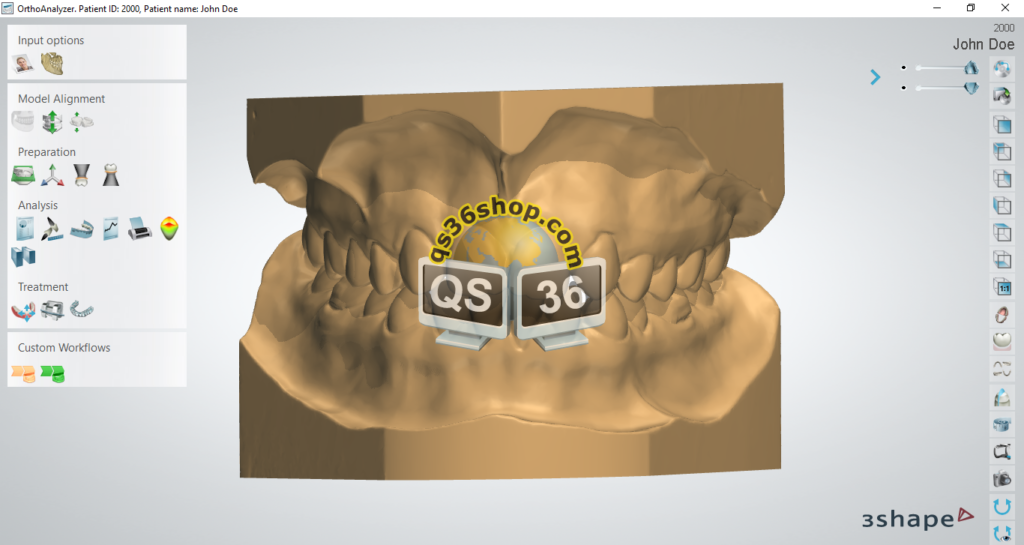 3Shape Ortho System OrthoAnalyzer 2019 Full – QS36 Shop