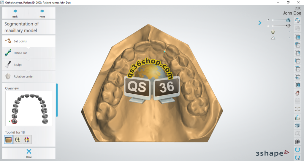 3Shape Ortho System OrthoAnalyzer 2019 Full – QS36 Shop