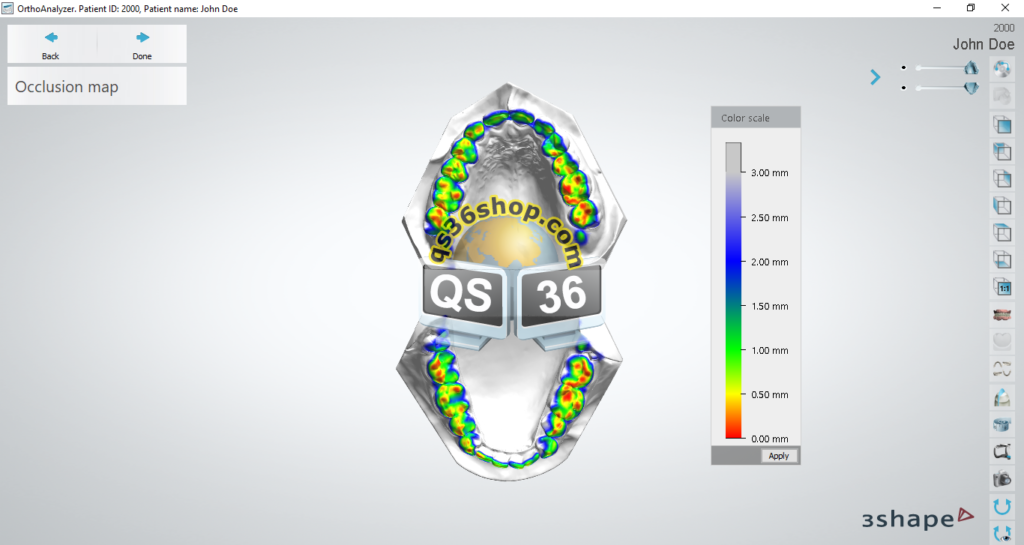 3Shape Ortho System OrthoAnalyzer 2019 Full – QS36 Shop