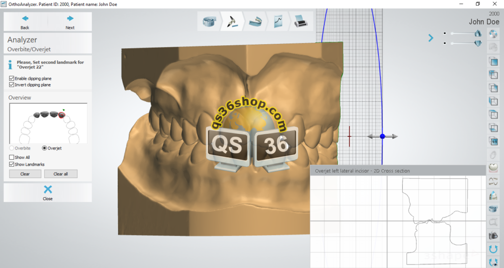 3Shape Ortho System OrthoAnalyzer 2019 Full – QS36 Shop