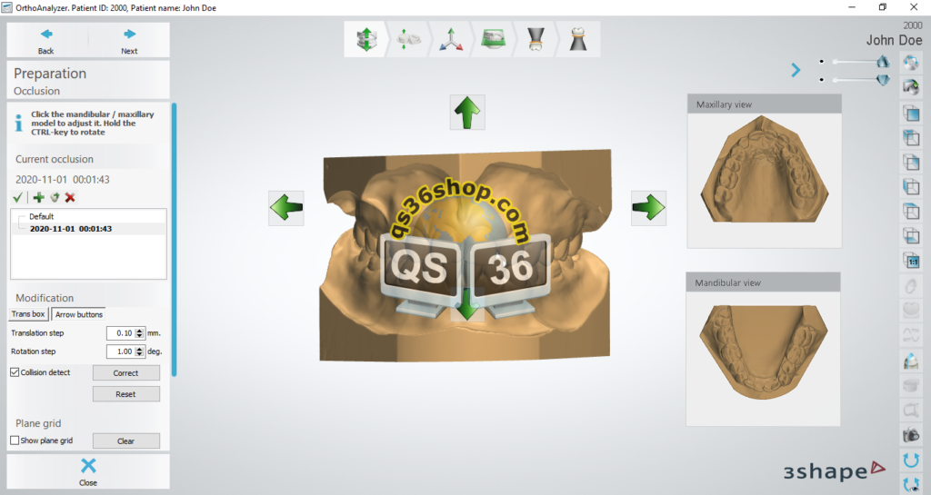 3Shape Ortho System OrthoAnalyzer 2019 Full – QS36 Shop