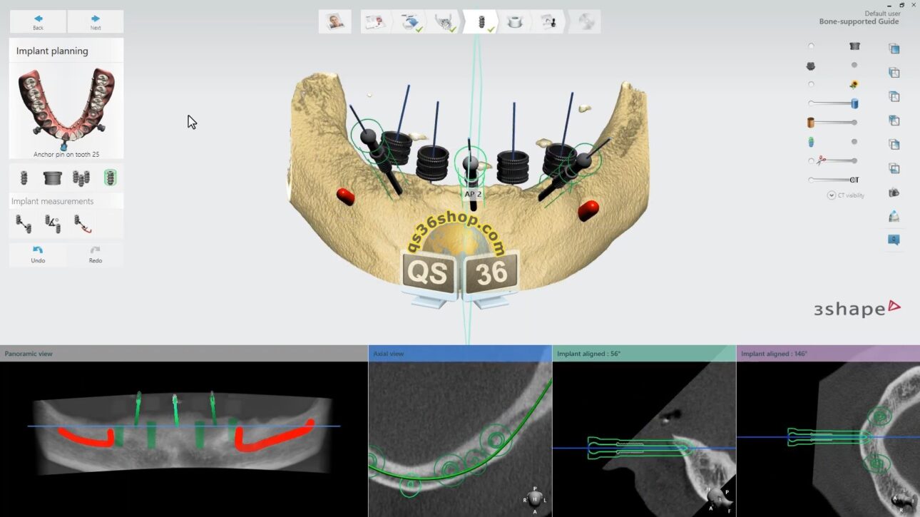3Shape Implant Studio 2020 Full – QS36 Shop