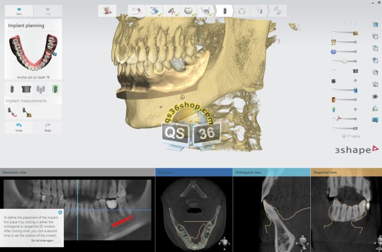 3Shape Implant Studio 2020 Full – QS36 Shop