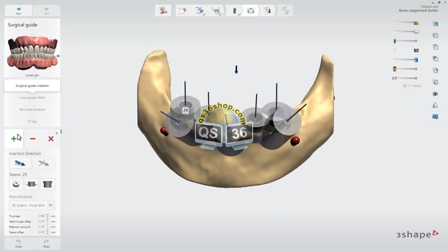 3Shape Implant Studio 2020 Full – QS36 Shop