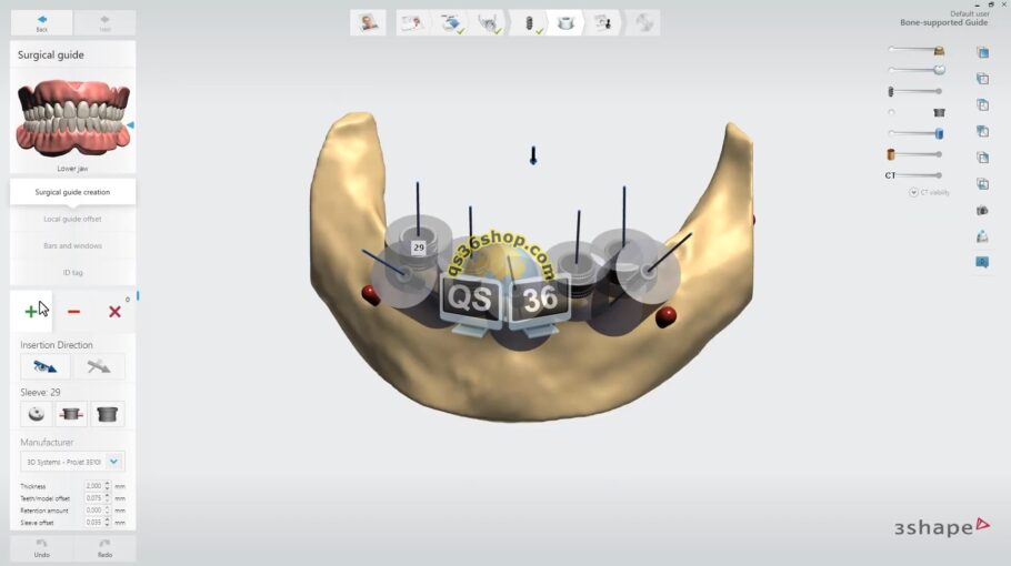 3Shape Implant Studio 2020 Full – QS36 Shop