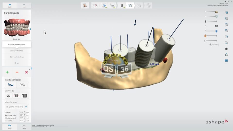 3Shape Implant Studio 2020 Full – QS36 Shop