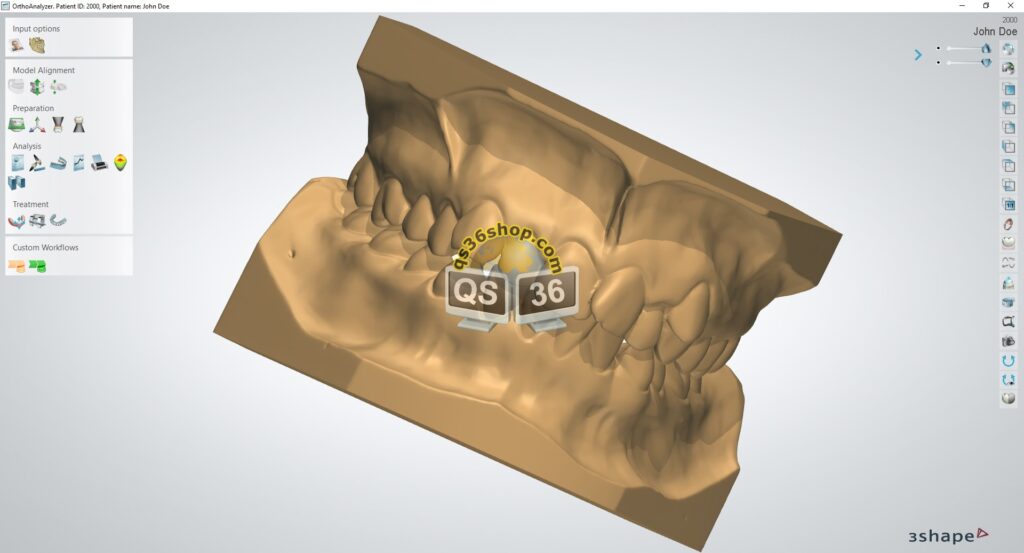 3Shape Ortho System OrthoAnalyzer 2020 Full – QS36 Shop