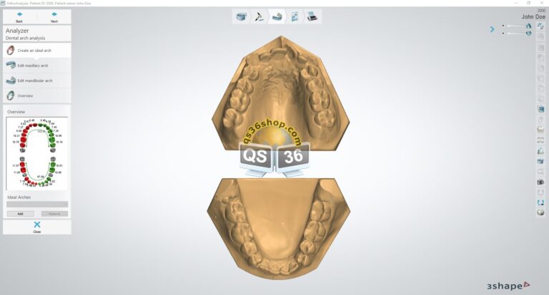 3Shape Ortho System OrthoAnalyzer 2020 Full – QS36 Shop