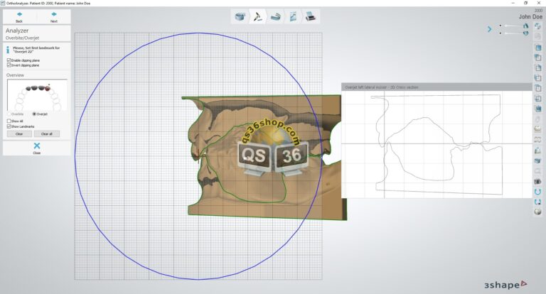 3Shape Ortho System OrthoAnalyzer 2020 Full – QS36 Shop
