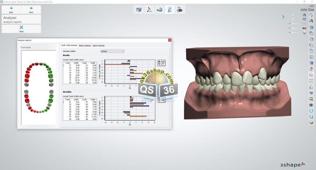 3Shape Ortho System OrthoAnalyzer 2020 Full – QS36 Shop