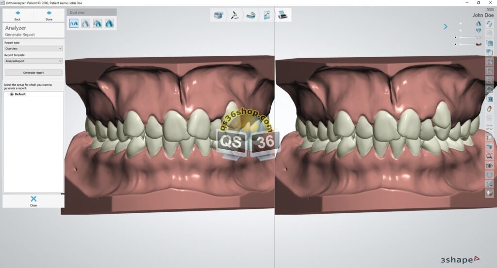 3Shape Ortho System OrthoAnalyzer 2020 Full – QS36 Shop
