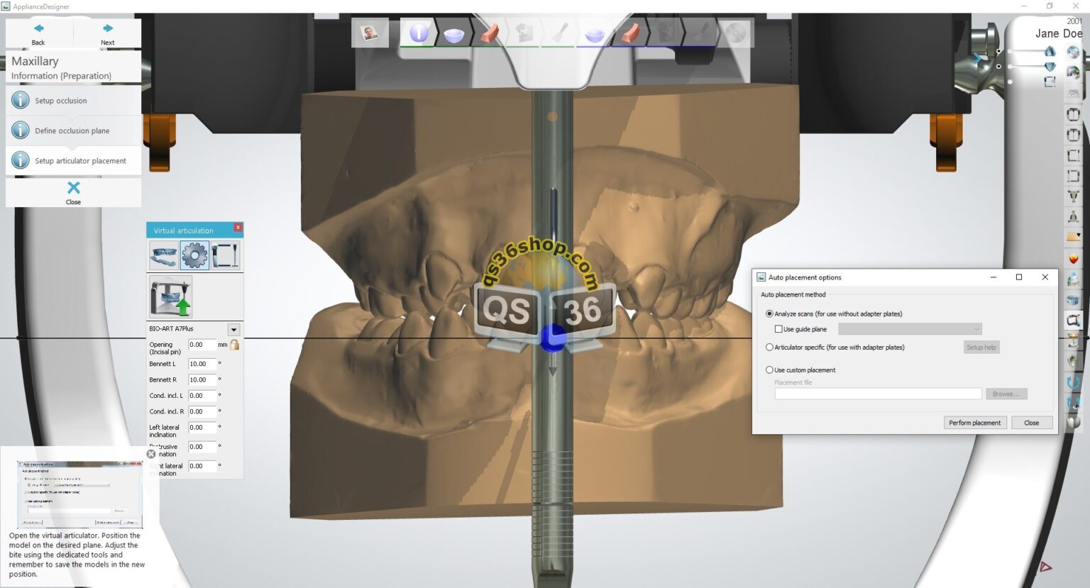 3Shape Ortho System OrthoAnalyzer 2020 Full – QS36 Shop