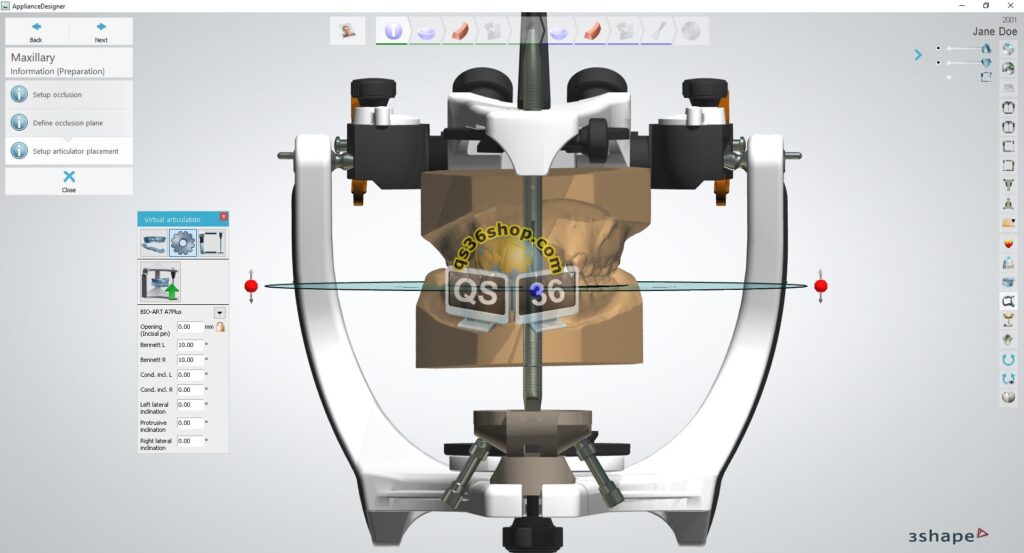 3Shape Ortho System OrthoAnalyzer 2020 Full – QS36 Shop
