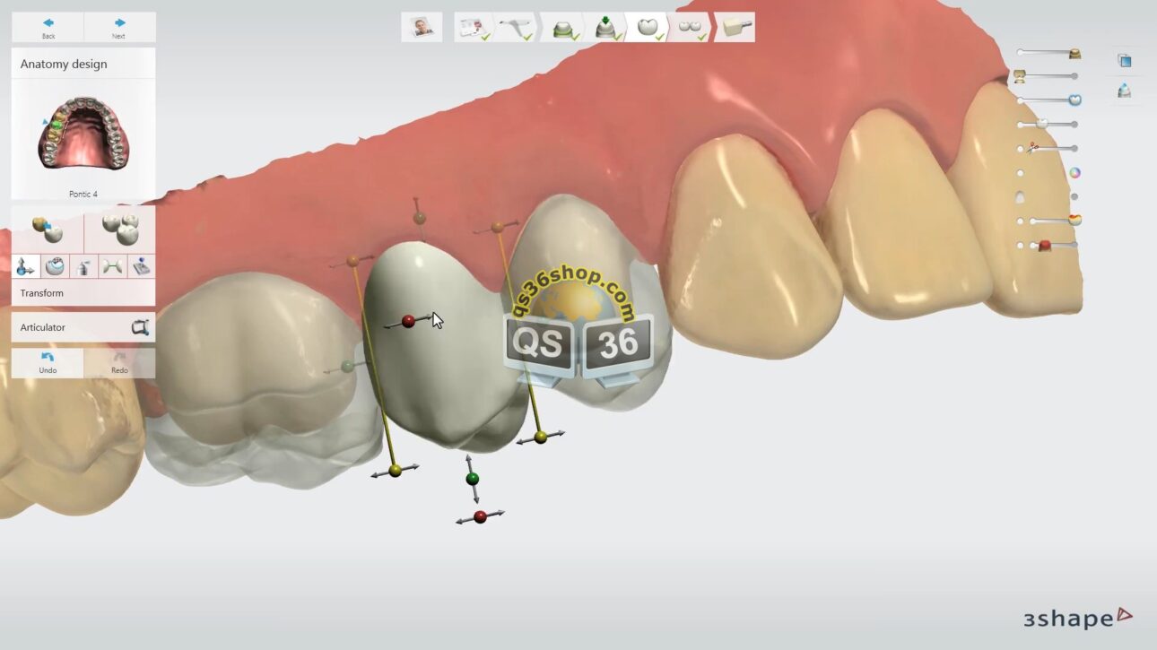 3Shape TRIOS Design Studio 2020 Full – QS36 Shop