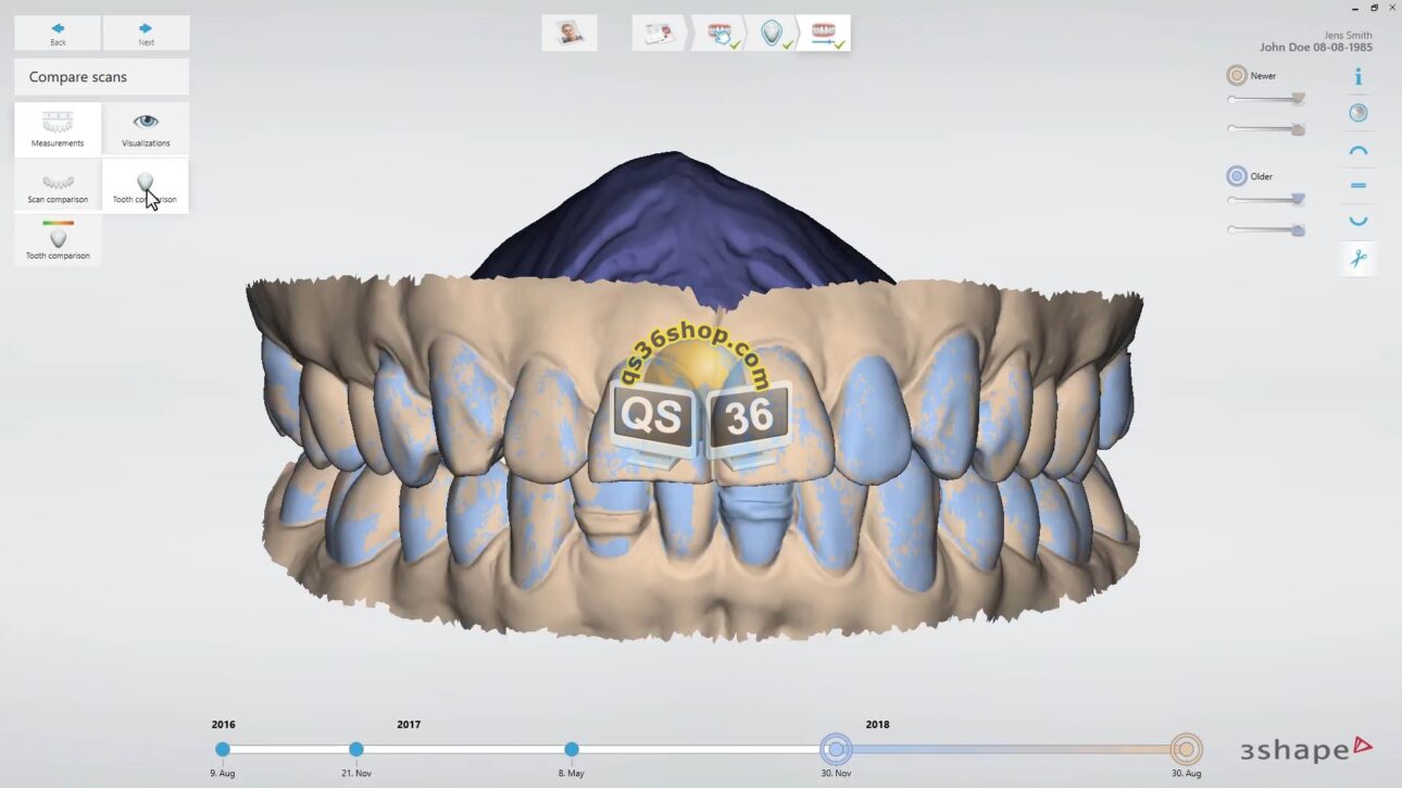 3Shape TRIOS Design Studio 2020 Full – QS36 Shop