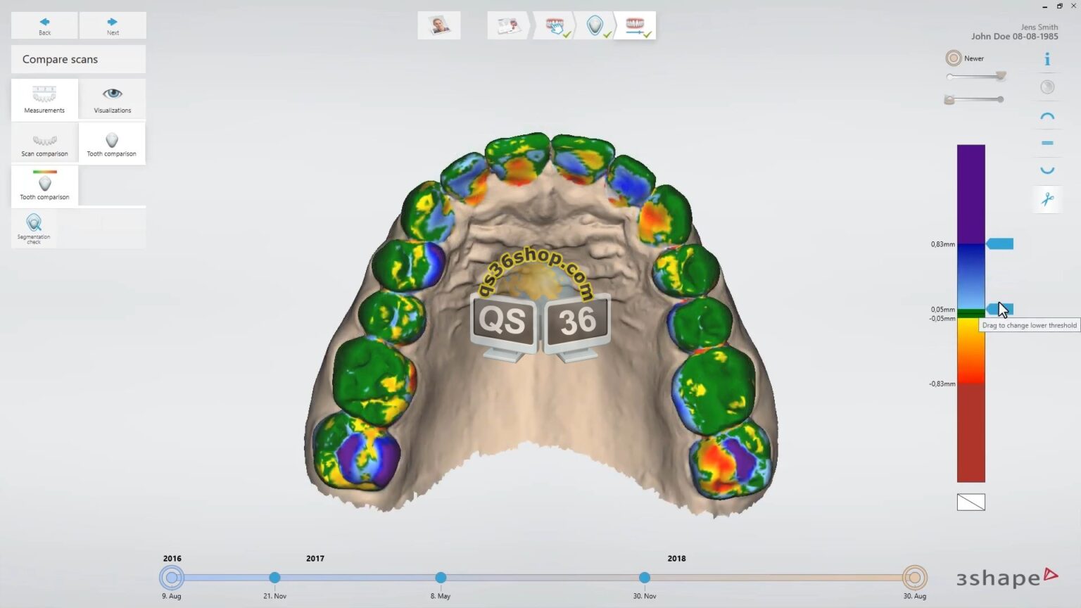 3Shape TRIOS Design Studio 2020 Full – QS36 Shop
