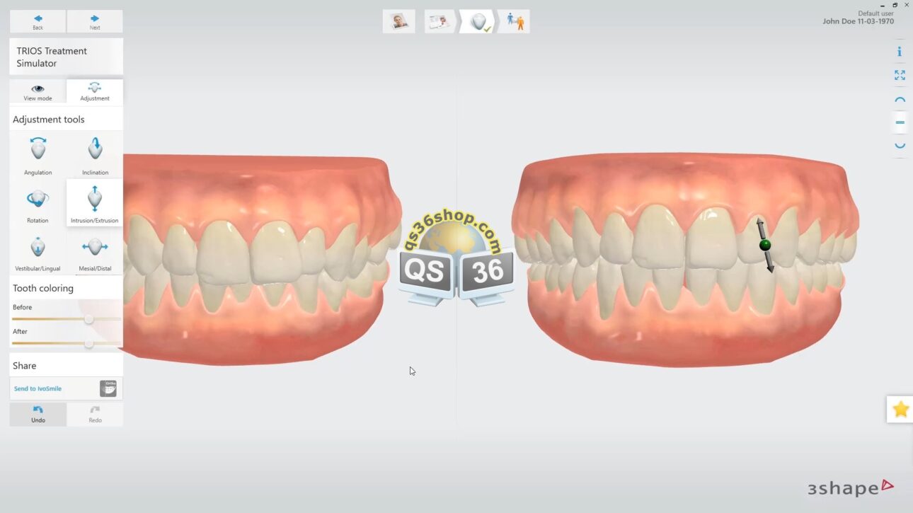 3Shape TRIOS Design Studio 2020 Full – QS36 Shop