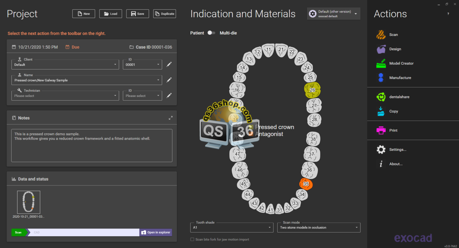Exocad 3.0 Galway Full – QS36 Shop