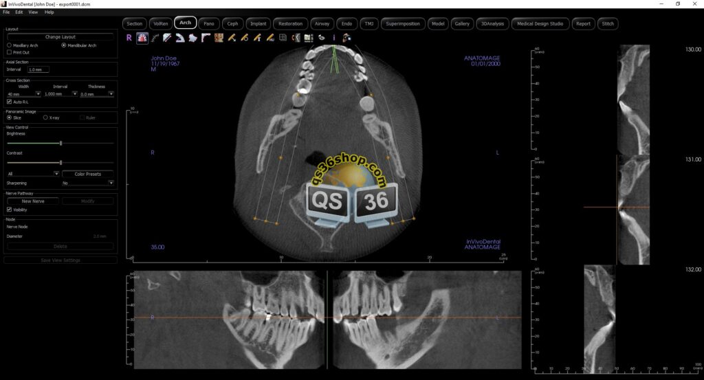 Invivo6 Full – QS36 Shop