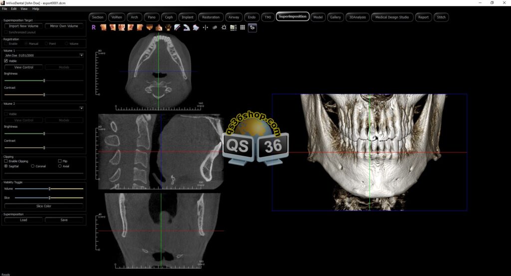 Invivo6 Full – QS36 Shop