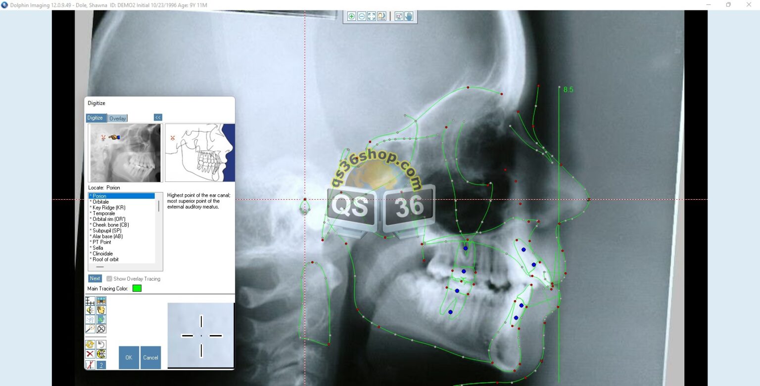 Dolphin Imaging 12 Premium Full – QS36 Shop