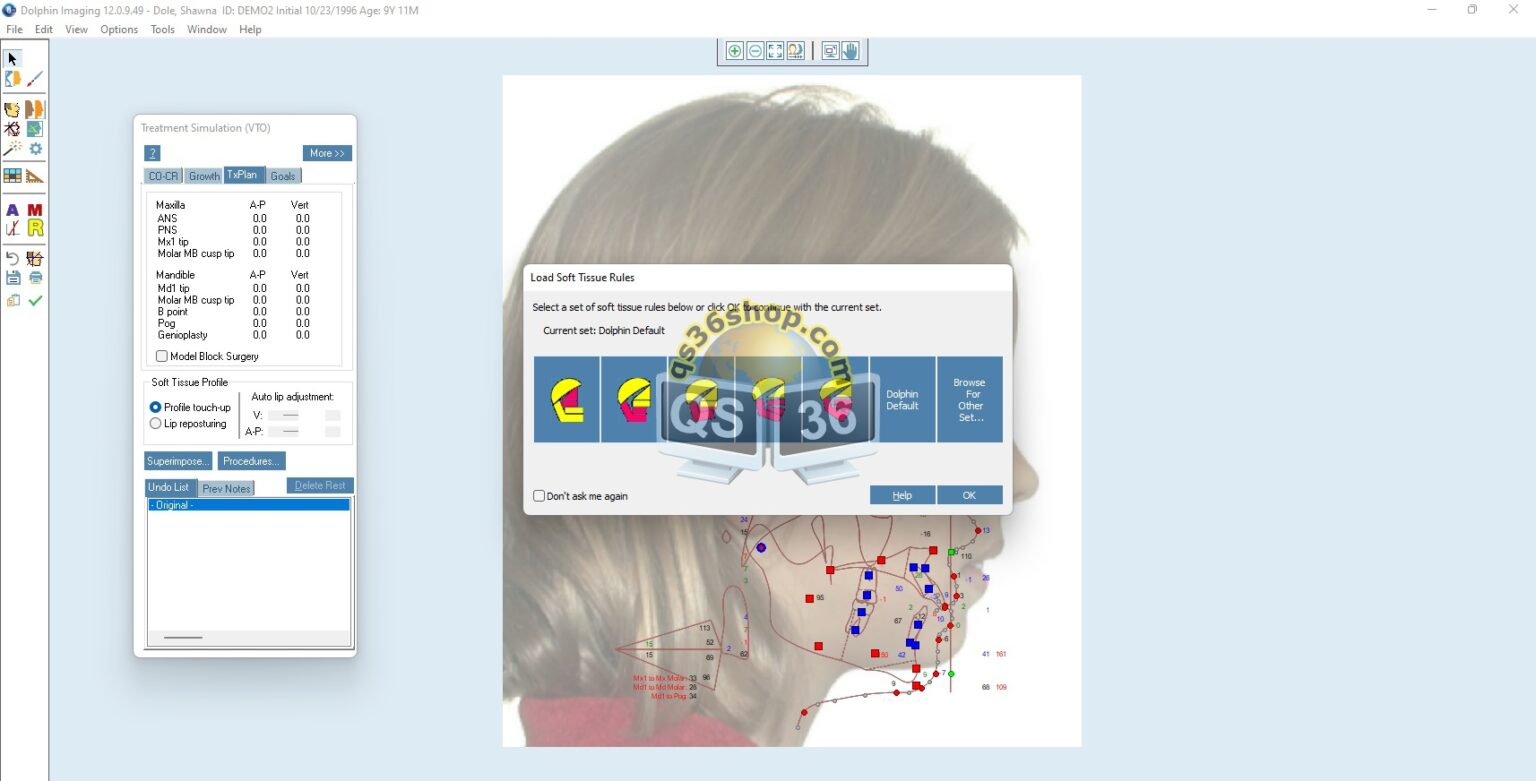 Dolphin Imaging 12 Premium Full – QS36 Shop