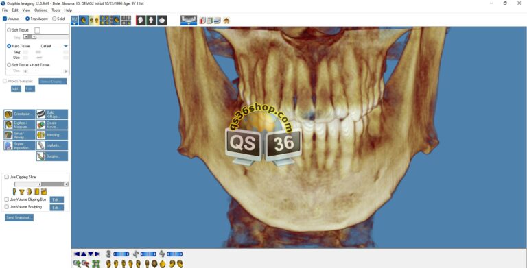 Dolphin Imaging 12 Premium Full – QS36 Shop