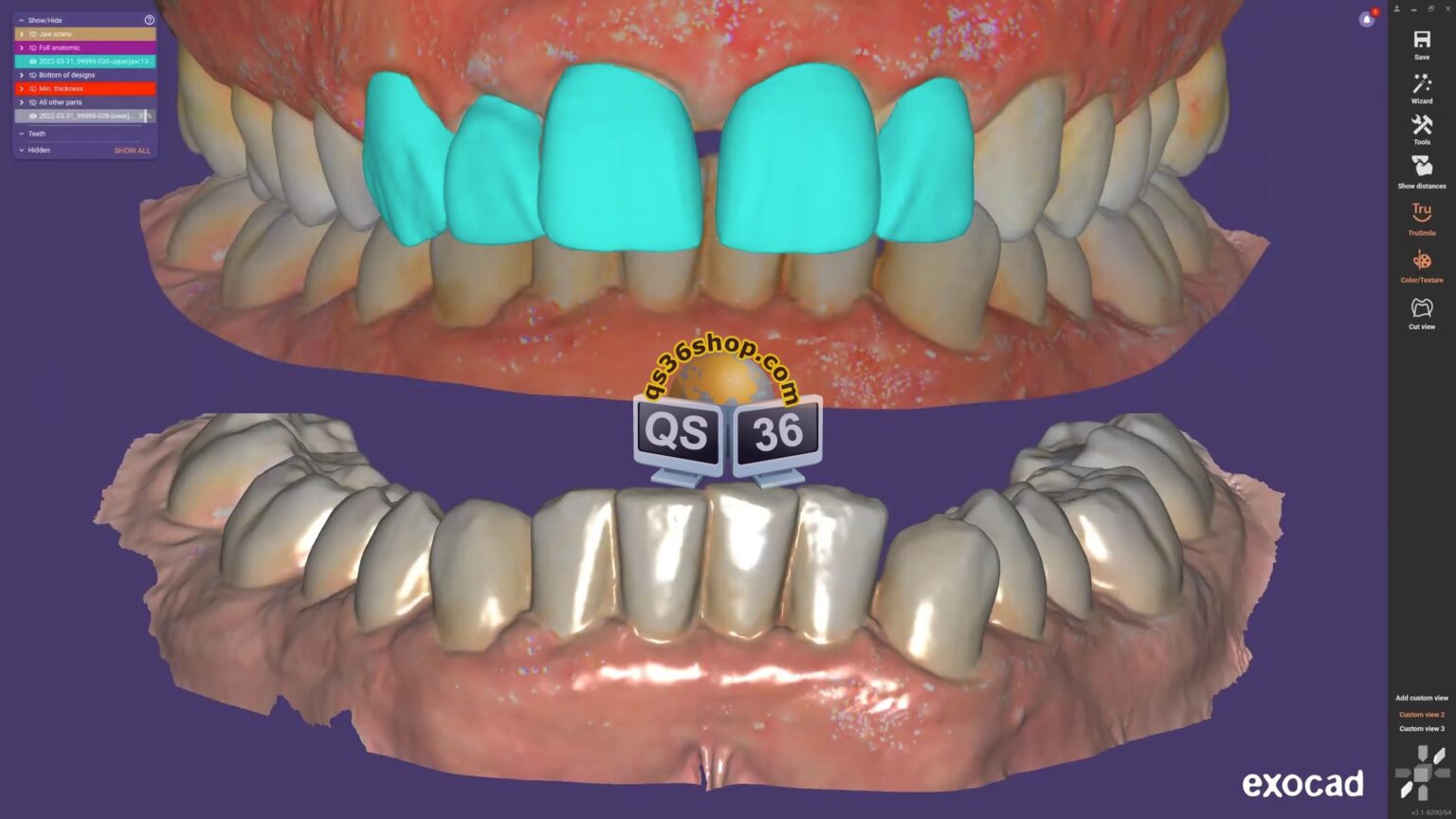 Exocad 3.1 Rijeka Full – QS36 Shop