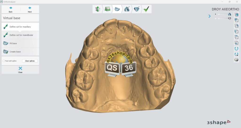 3Shape Ortho System OrthoAnalyzer 2022 Full – QS36 Shop