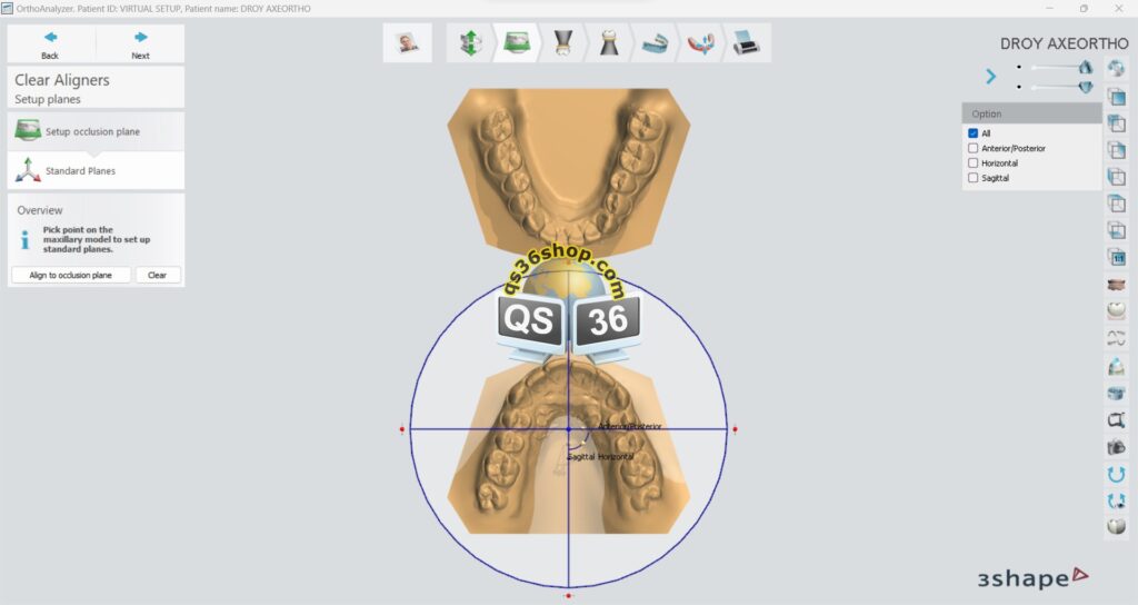 3Shape Ortho System OrthoAnalyzer 2022 Full – QS36 Shop