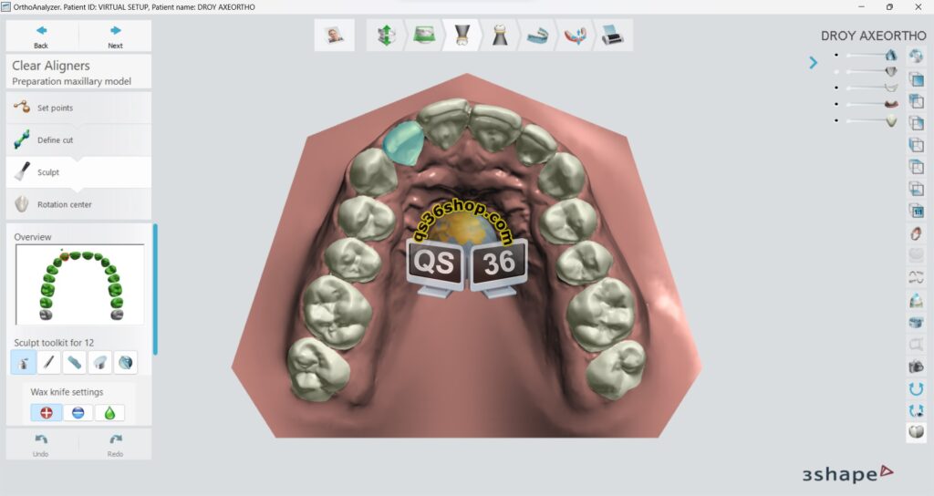 3Shape Ortho System OrthoAnalyzer 2022 Full – QS36 Shop