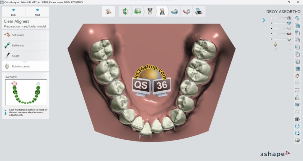 3Shape Ortho System OrthoAnalyzer 2022 Full – QS36 Shop