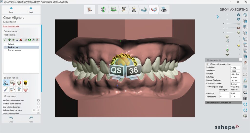 3Shape Ortho System OrthoAnalyzer 2022 Full – QS36 Shop