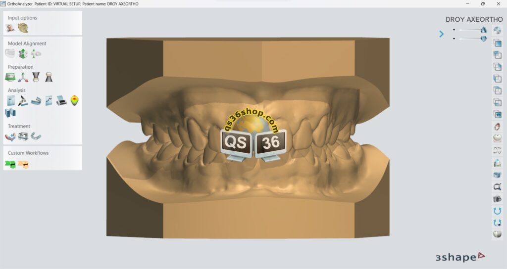 3Shape Ortho System OrthoAnalyzer 2022 Full – QS36 Shop