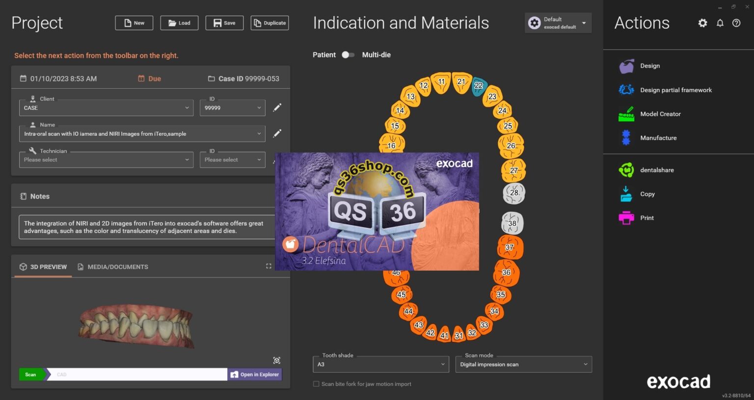 Exocad 3.2 Elefsina Full – QS36 Shop