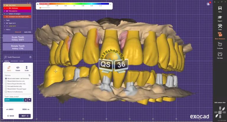 Exocad 3.2 Elefsina Full – QS36 Shop