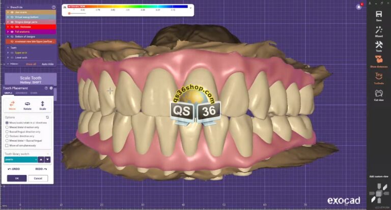 Exocad 3.2 Elefsina Full – QS36 Shop