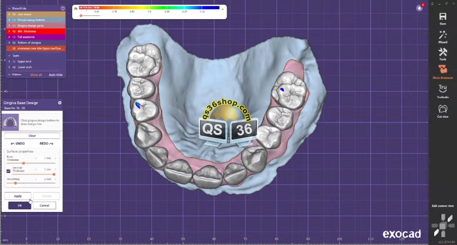 Exocad 3.2 Elefsina Full – QS36 Shop