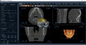 Invivo 7.1 Full – QS36 Shop