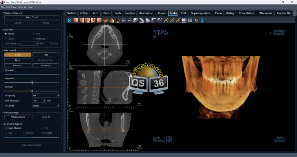Invivo 7.1 Full – QS36 Shop