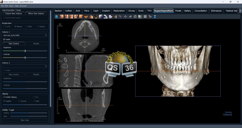 Invivo 7.1 Full – QS36 Shop