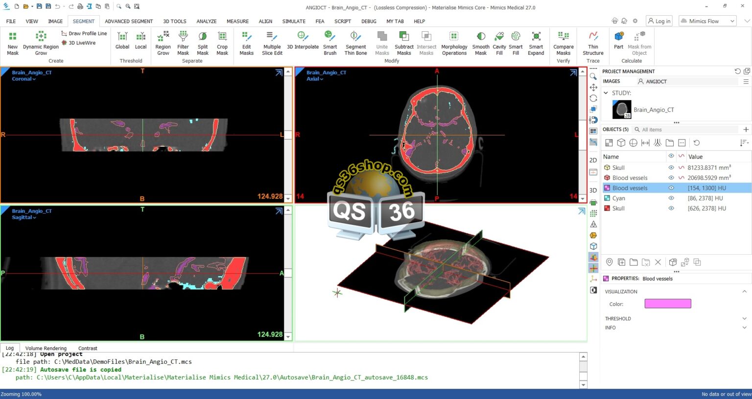 Mimics Core Medical 27.0 Full – QS36 Shop